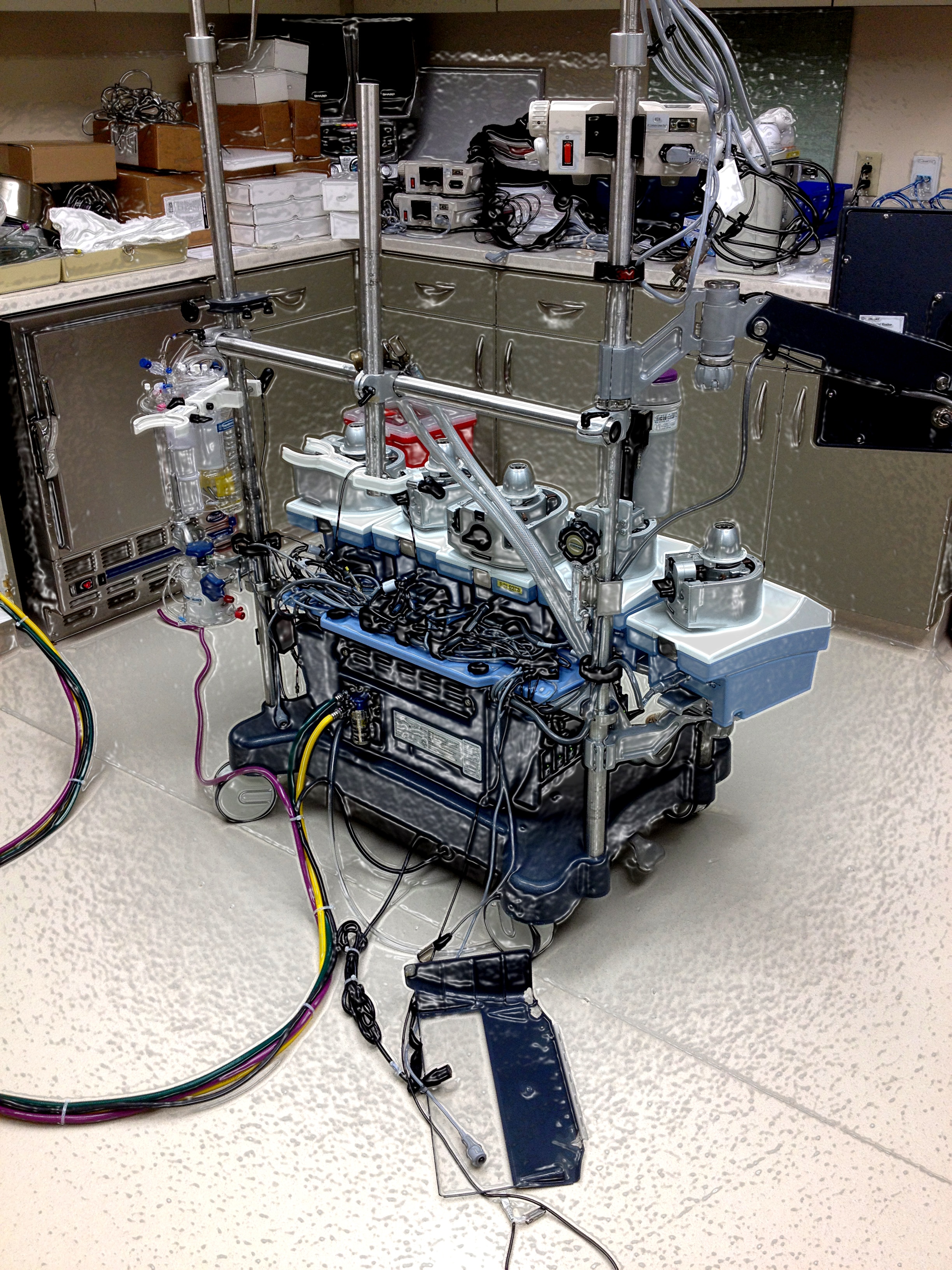 COVID-19 FAQ’s in Pediatric Cardiac Surgery - Perfusion.com