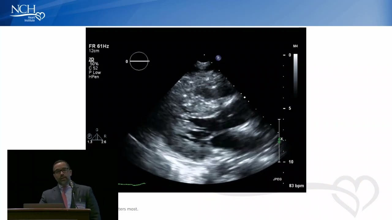 Developing a New ECMO Program - Perfusion.com