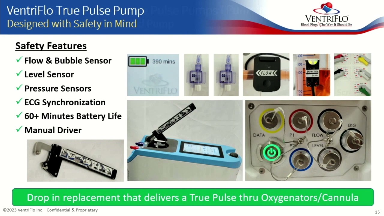 Early Evidence Supports Potential Benefits of VentriFlo True PulsePump ...