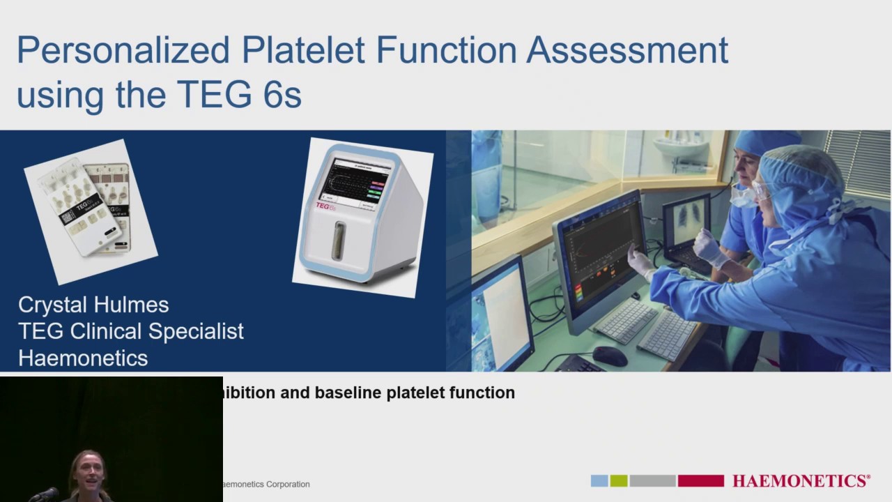 Personalized Platelet Function Assessment Using the TEG Coagulation ...